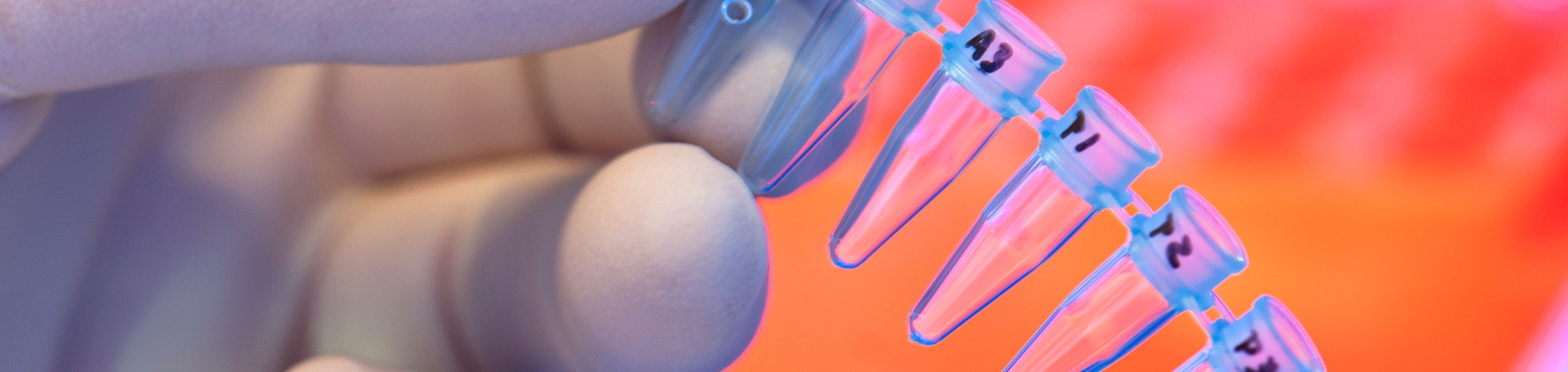 De-novo & Reference Based RNA Sequencing | Eurofins India De-novo & Reference Based RNA Sequencing | Eurofins India